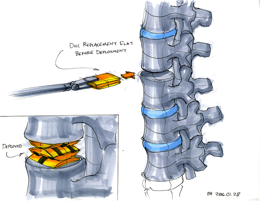 Tiny surgical tools inspired by origami | Design Indaba