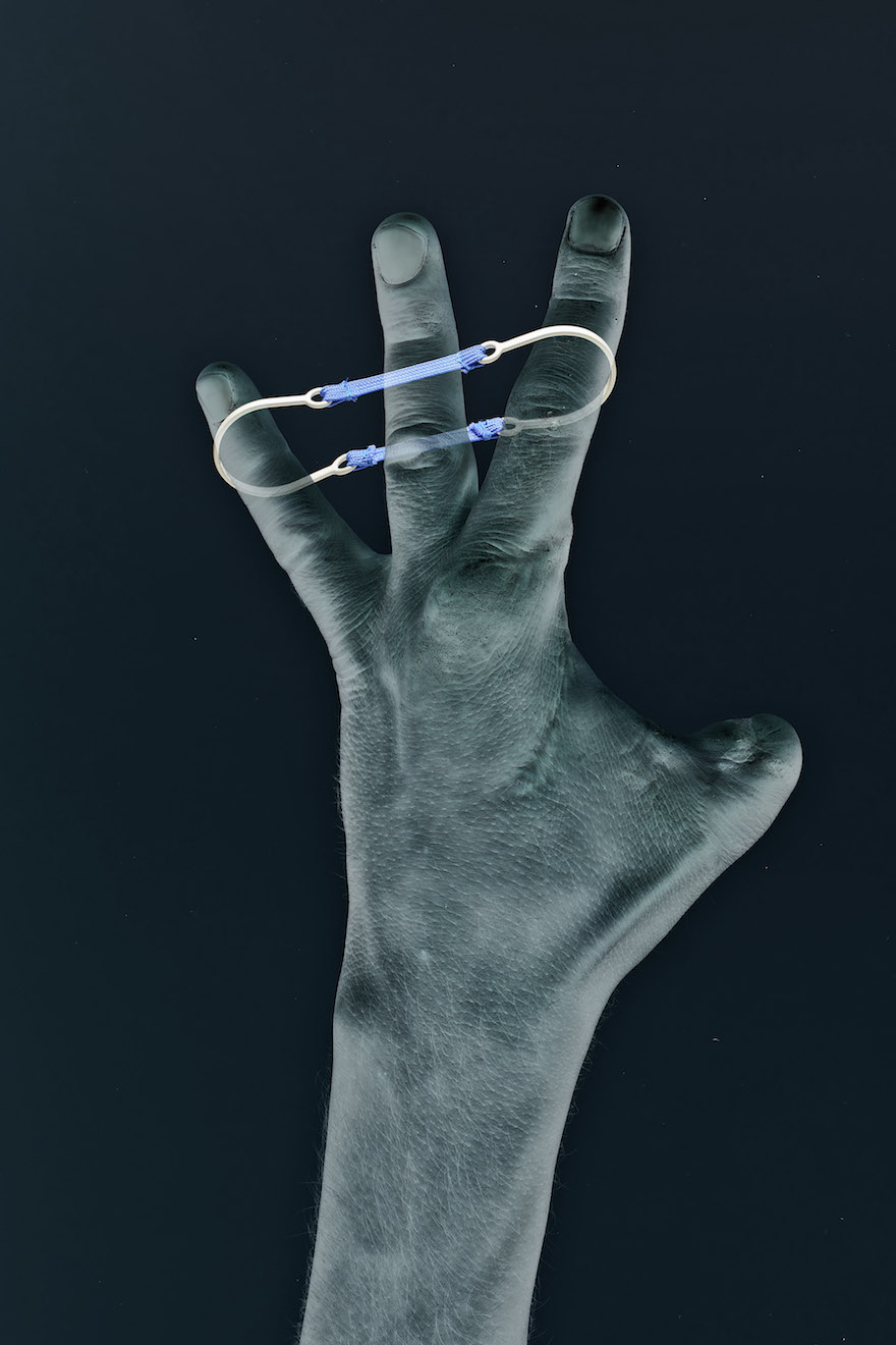 Healing, Movement, Stimulation: Design for phantom pain | Design Indaba