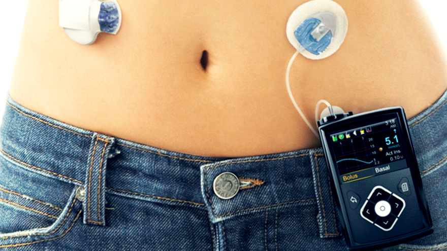 The Minimed device brings easy living to Diabetics | Design Indaba